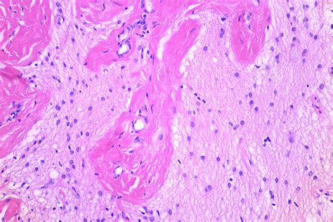 Judy Melinek Md On Twitter Rt Geronimojrlapac A Rare Case Since Judy Melinek Md On Twitter Rt Geronimojrlapac A Rare Case Since