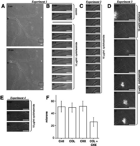 Intra Axonal Protein Synthesis Maintains The Growth Cone To Address Download Scientific