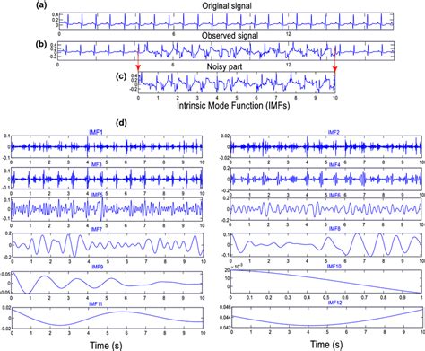 Illustration Of The Ceemdan Decomposition Ecg Signal Without