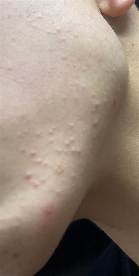 얼굴 화이트 헤드 지식in