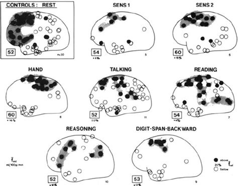 Four Different Hierarchically Organized Conditions Are Represented In Download Scientific