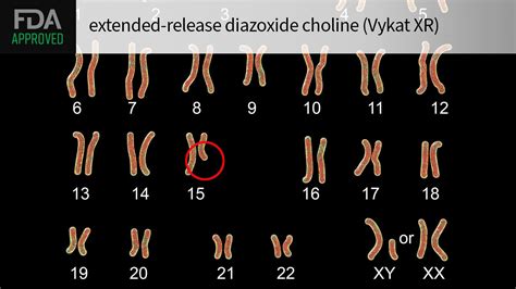 Fda Oks First Drug For Hyperphagia In Prader Willi Syndrome