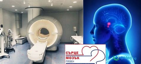 ЯМР на ХИПОФИЗА от УМБАЛ Сърце и Мозък гр Плевен