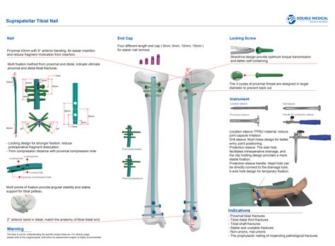 Sptn Supra Patella Tibial Nailmedical Device Manufacturers Double Medical
