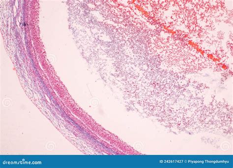 Histological Ovary Testis And Sperm Human Cells Under Microscope