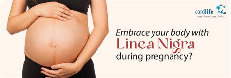 Embrace Your Body With Linea Nigra During Pregnancy