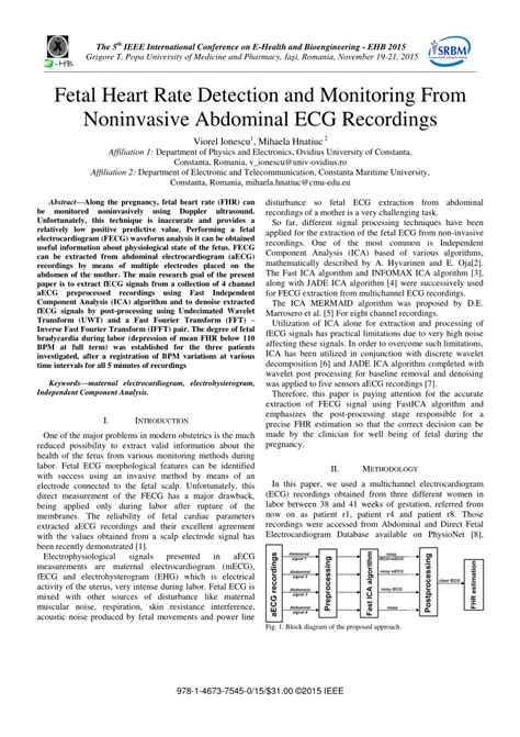 Pdf Fetal Heart Rate Detection And Monitoring From Noninvasive Abdominal Ecg Recordings