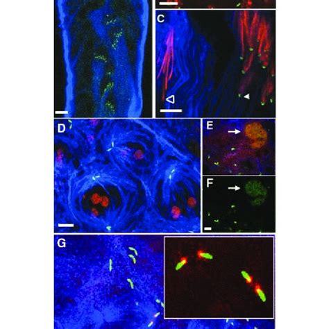 Unc GFP Localization In Spermatogenesis Confocal Images Of Spermatids Download Scientific
