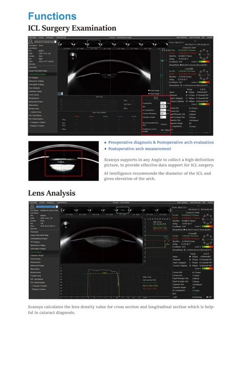 Scansys Anterior Segment Analyzer At ₹ 2565000 Corneal Topographer In Kolkata Id 2856295550112