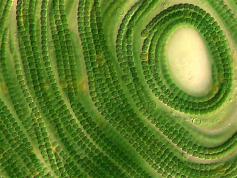 Phycokey Anabaenopsis Images