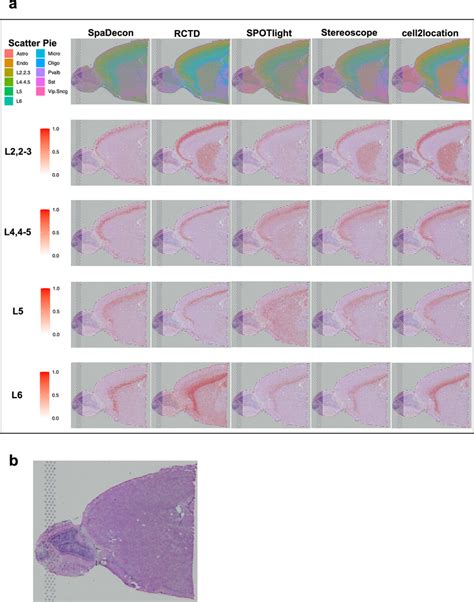 Cell Type Deconvolution Results For 10x Visium Mouse Brain Serial Download Scientific Diagram