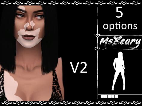 Sims 4 Vitiligo Skin Detail Jesproxy