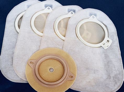 What Should Stool Consistency Be After An Ileostomy