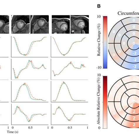 Intra Scanner Repeatability Of Global And Regional Myocardial Strain Download Scientific