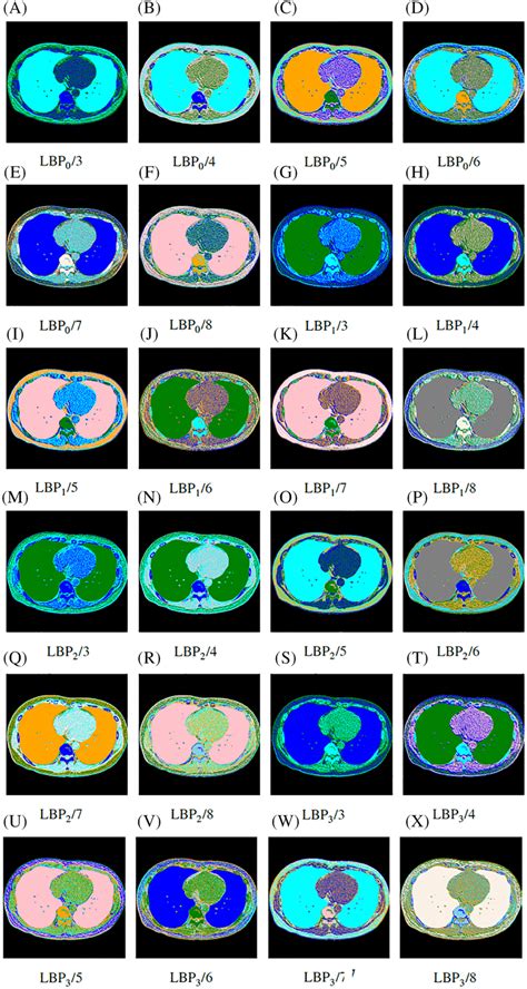 Segmentation Of Img002 In Local Binary Pattern Lbp0‐lbp3 With K 3 To 8 Download Scientific