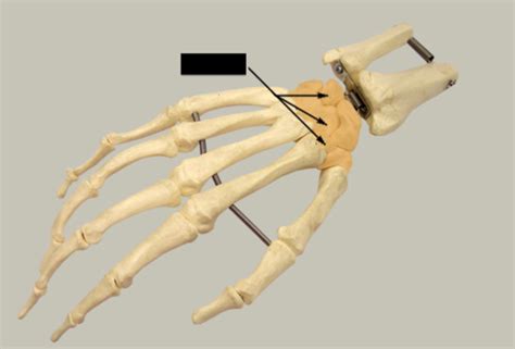 A P Lab Appendicular Skeleton ID Flashcards Quizlet