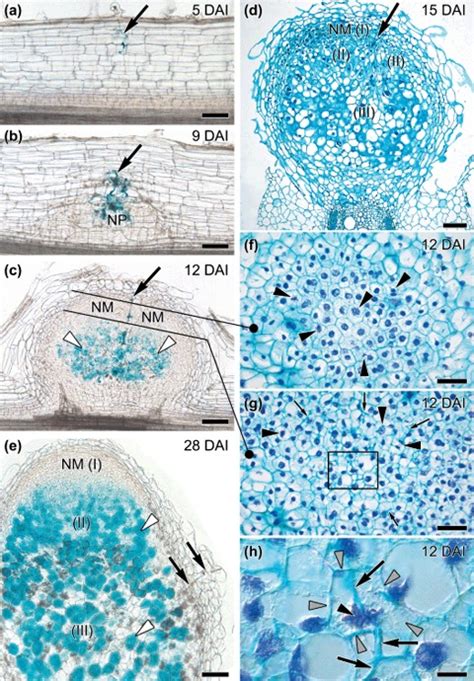 Symbiotic Root Nodule Development In Wild Type Line SGE Of Pisum Download Scientific Diagram