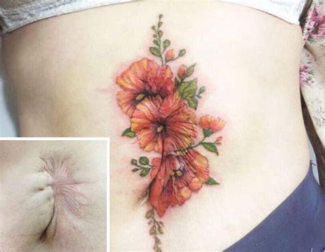 This Vietnamese Tattoo Artist Helps People Regain Confidence With Her