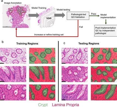 development of an ai ml algorithm for uc tissue segmentation a the