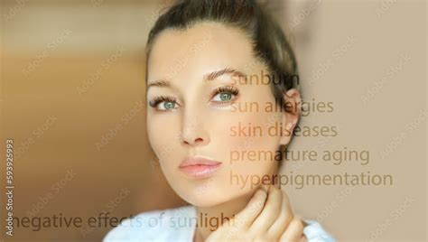 Negative Effects Of Sunlight Hyperpigmentation Premature Aging Sun Allergiesskin Diseases