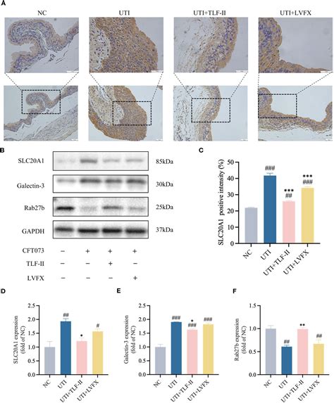 Uropathogenic Escherichia Coli Infection Innate Immune Disorder