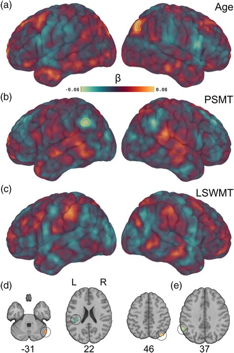 Age And Memory Ability Showed Regional Covariance With Download Scientific Diagram