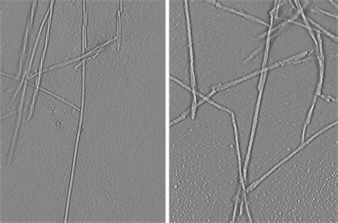 Cryo Et And Cryo Em Structure Of Asyn A Electron Negative Stain Download Scientific Diagram