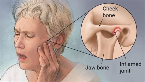 Tmj Treatment In Corpus Christi Tx Boss Dental Care