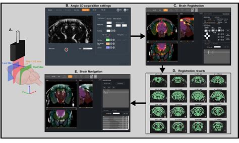 Whole Brain 3d Activation And Functional Connectivity Mapping In Mice