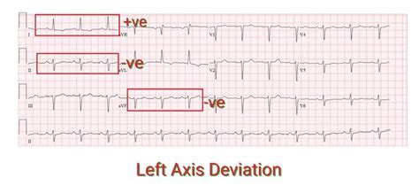 Pin On Ιατρική