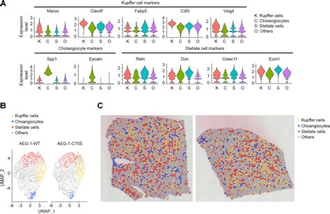 Spatial Transcriptomics Unravels Palmitoylation And Zonation Dependent
