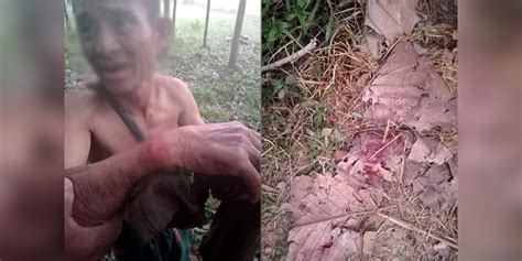 Dvb ဘားအံမြို့နယ်တွင် စစ်တပ်က လက်နက်ကြီးပစ်ခတ်သဖြင့် ရွာသား ၂ ဦးဒဏ်ရာရ