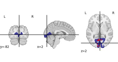 Gene Expressions — Siibra Python Documentation