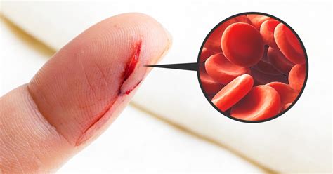 8 признаков густой крови которые нельзя игнорировать ни в каком