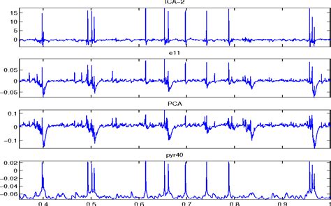 Figure 2 From Unsupervised Spike Sorting With Ica And Its Evaluation