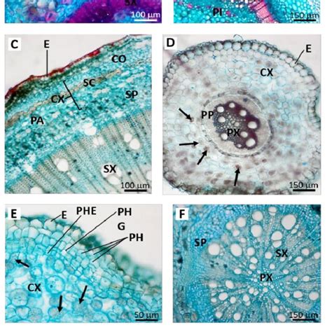 A Transverse Section Of The Stem In Primary Growth Of S Paniculatum