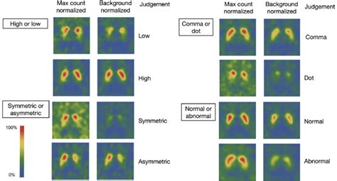 Determination Of Image Features Features Of High Or Low Symmetric Or Download Scientific