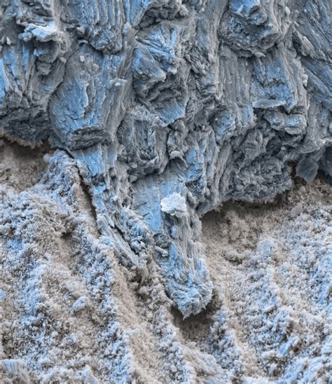 Malformed Tooth Enamel Sem Stock Image C057 8548 Science Photo Library