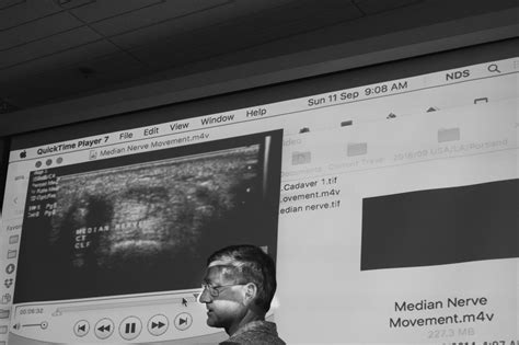 Upper Quarter 2 Course Neurodynamic Solutions