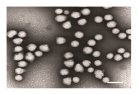 Nanoparticle Size Distribution And Morphology A Narrow Size