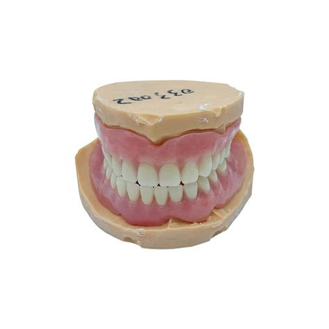 Acrylic Partial Denture Solutions Istar Dental Lab