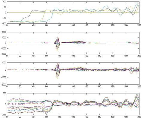 Results Of 12 Lead Ecg With Mcmc Top Atrial Part Of Tmp 2nd Download Scientific Diagram