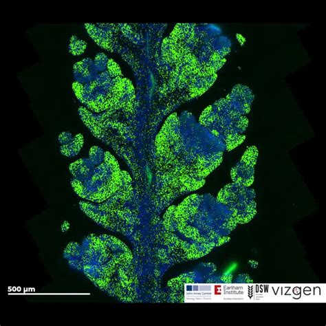 Vizgen On Linkedin Spatialbiology Merfish Transcriptomics Vizgen On Linkedin Spatialbiology Merfish Transcriptomics