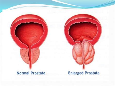 Alpha Blockers Class Pptx Heart And Cardiovascular Diseases Diseases And Conditions