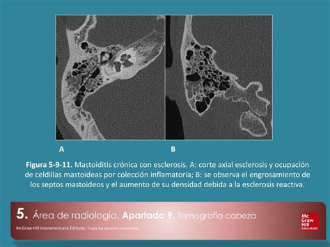 Ppt 5 Área De Radiología Powerpoint Presentation Free Download