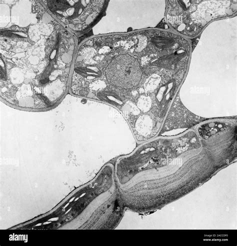 Leaf Epidermis Transmission Electron Micrograph Tem Of A Section