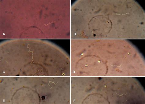 Microscopic Observation Of Leptospira With A 100× Magnification Optical Download Scientific