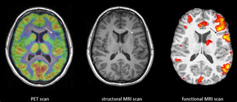 Know The Difference Between Mri And Fmri