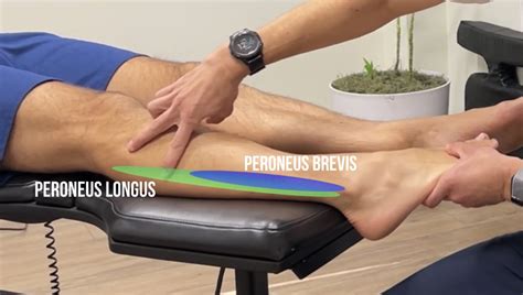 Peroneal Tendonitis Treatment San Diego