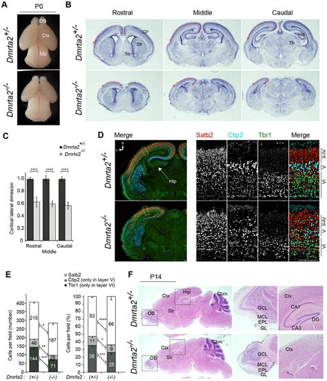 Reduced Cortical Size In Dmrta2 Deficient Mice A Newborn P0 Brains Download Scientific